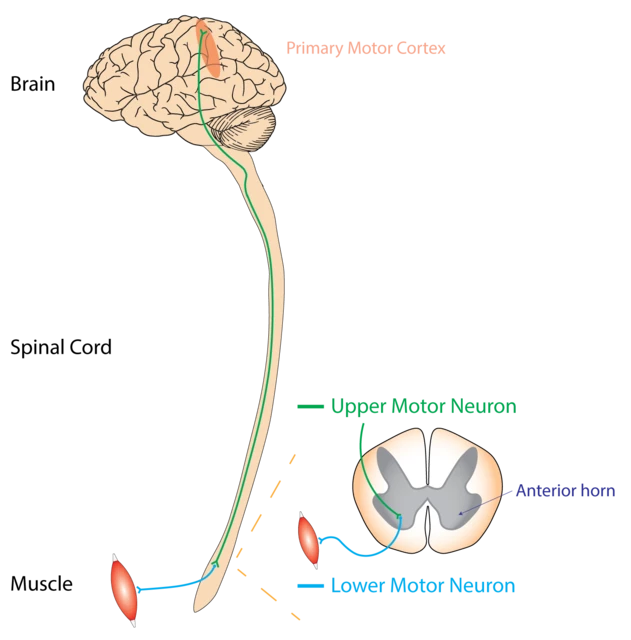 Damaged Motor Cortex