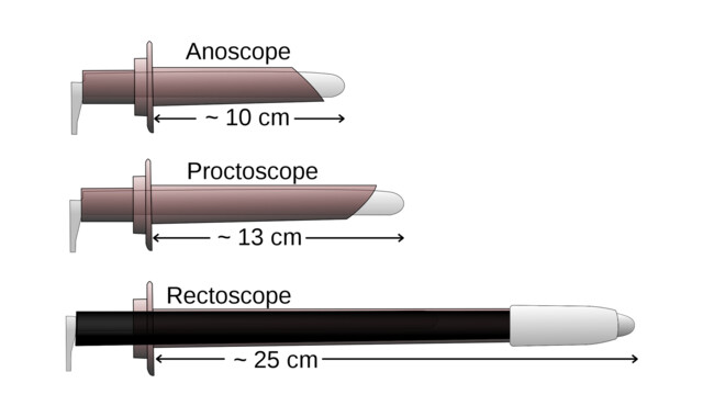 Anoscopy: Why Is It Done and What the Results Mean - StoryMD