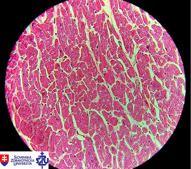 Trabeculae Carneae Histology