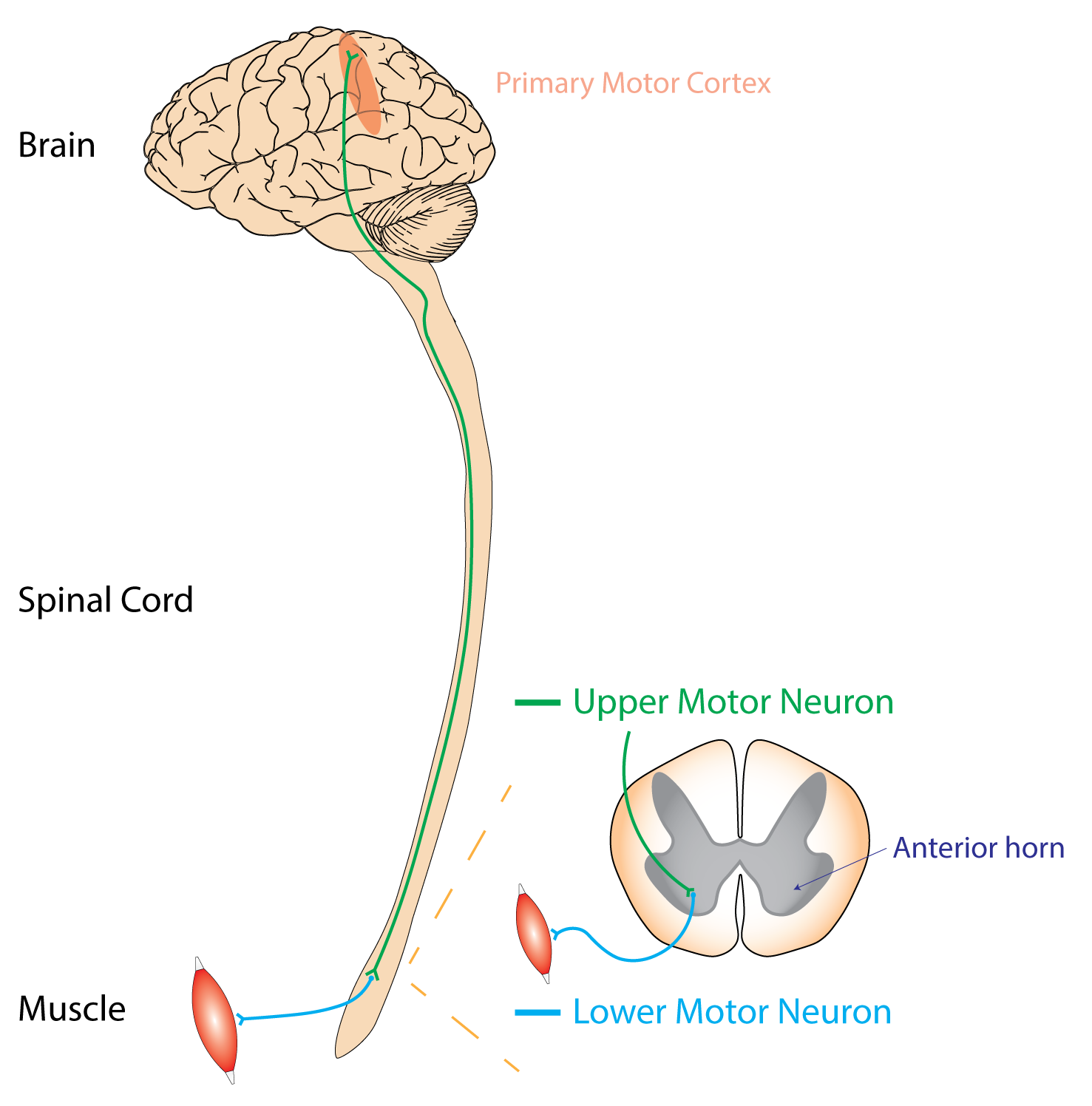 Upper Motor Neuron Symptoms Als - Infoupdate.org