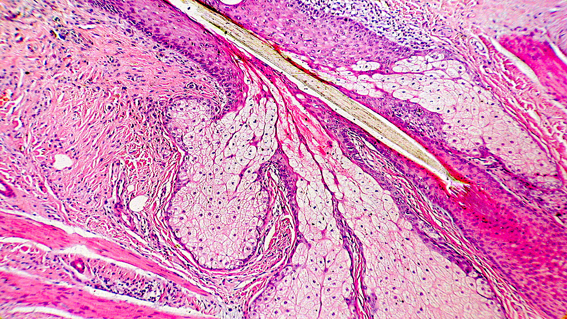 Sebaceous Glands StoryMD