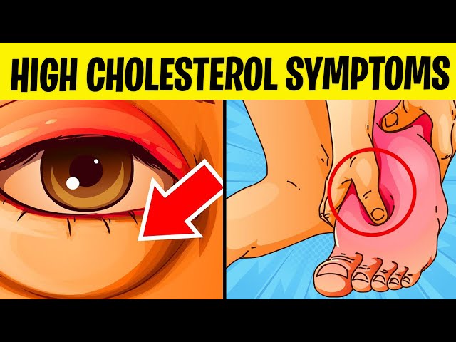 High Cholesterol Symptoms