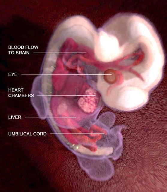 How Big Is A 7 Week Embryo Human Embryo: 6 7 Weeks | This Is An