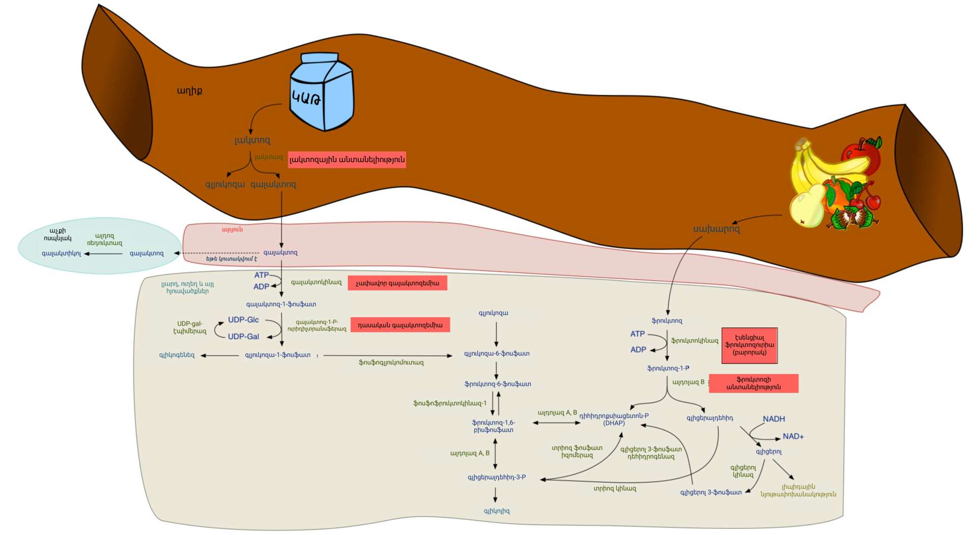Galactosemia Symptoms Toddlers Galactosemia Foundation