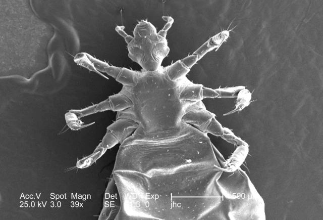 Lice Under Microscope What Does Lice Look Like? Pictures Of Nits, Eggs