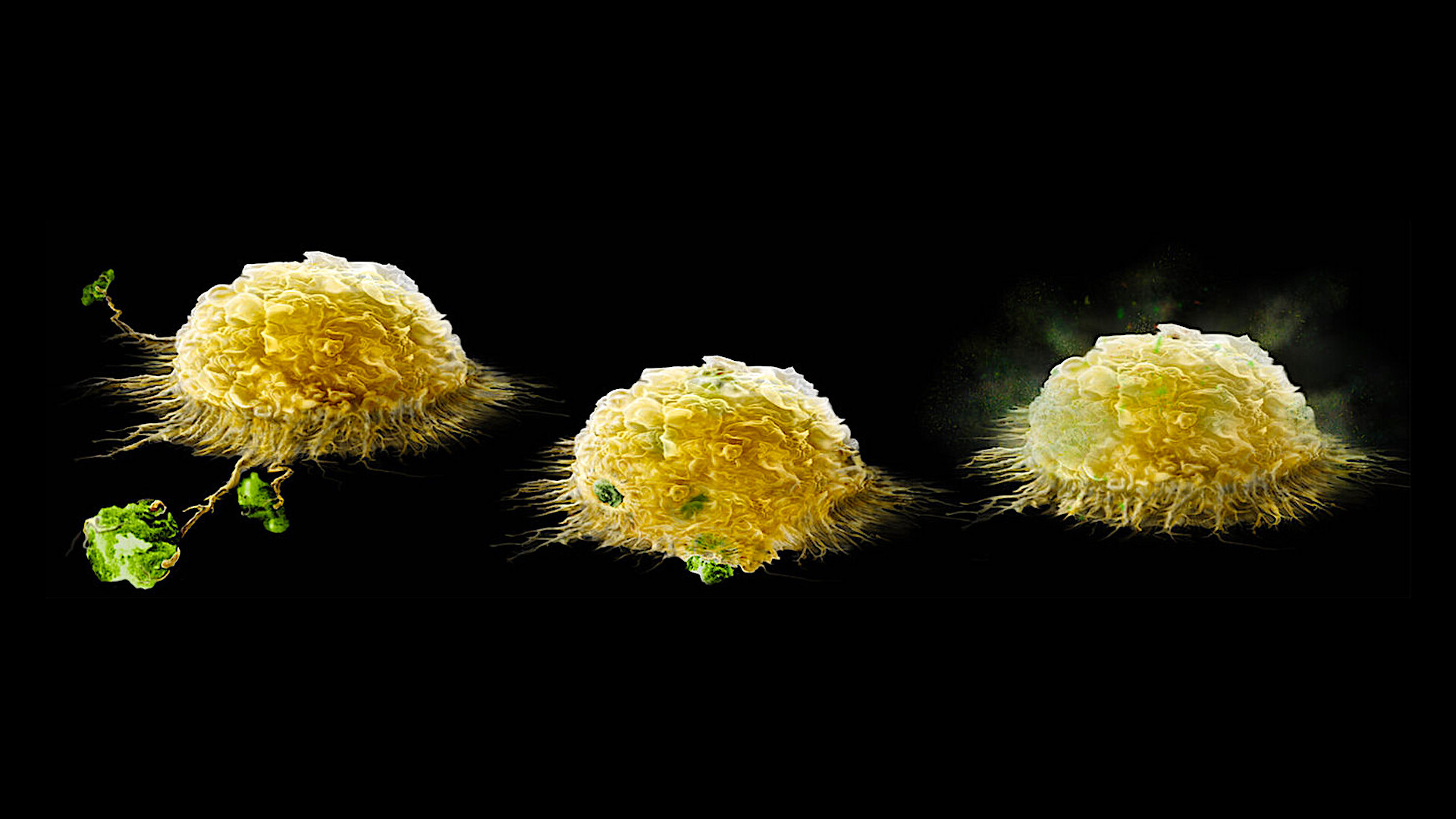 Killer T Cells Microscope