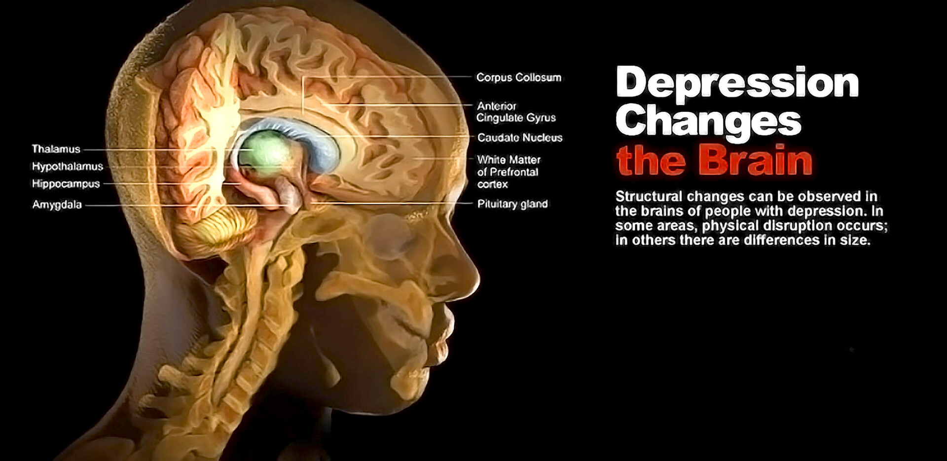 Define Depression Anatomy
