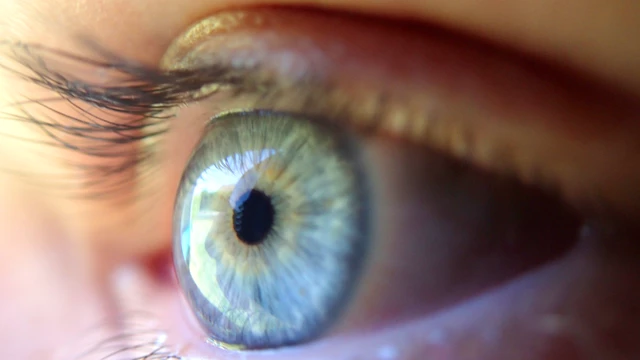 Meesmann Corneal Dystrophy Corneal Dystrophy | Treatment & Management