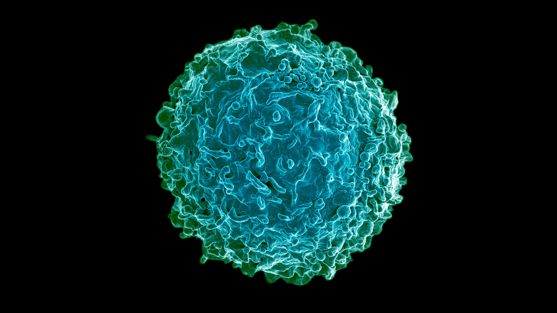 B Lymphocytes StoryMD B Lymphocytes StoryMD