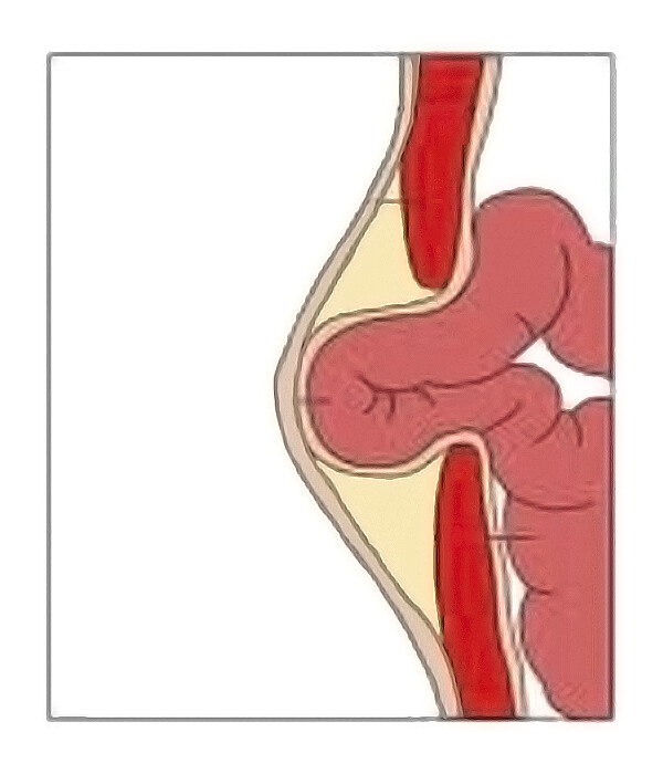 Umbilicus Anatomy