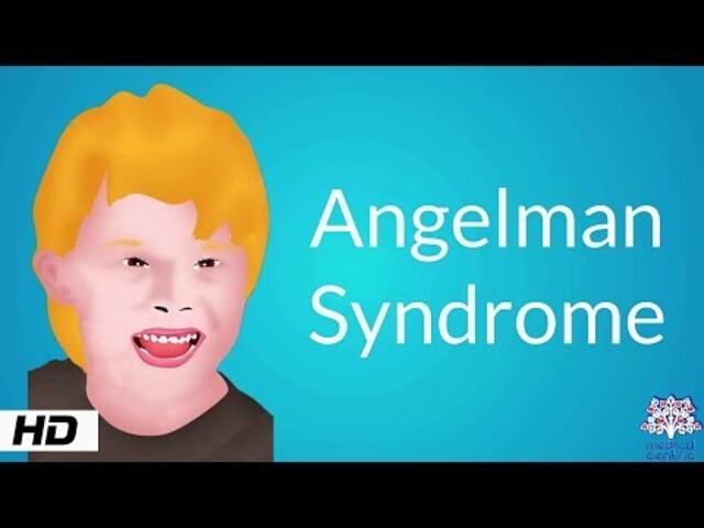 Angelman Syndrome Signs