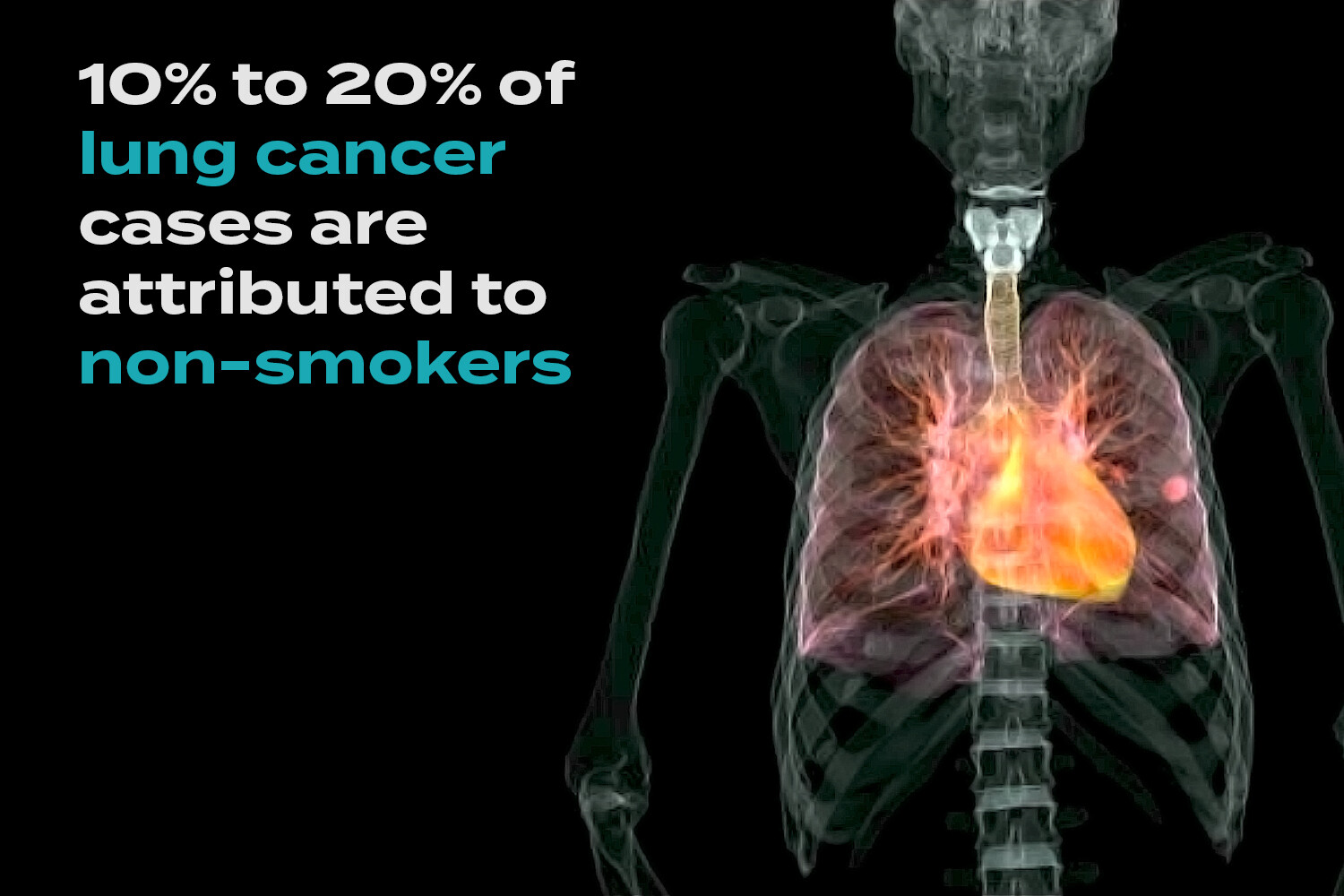 Lung Cancer From Smoking Lung Cancer Hits Non Smoking Indians Earlier