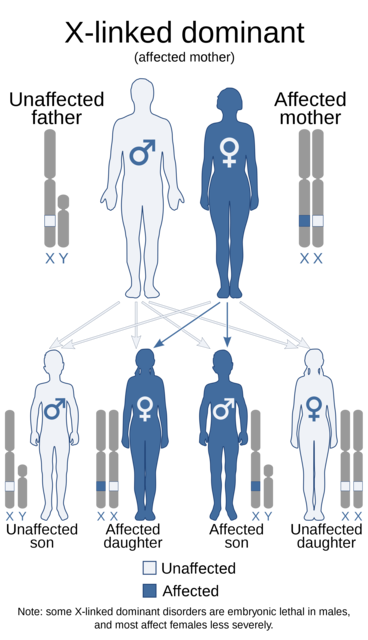 X Linked Dominant Inheritance Examples Pedigree Analysis Types,