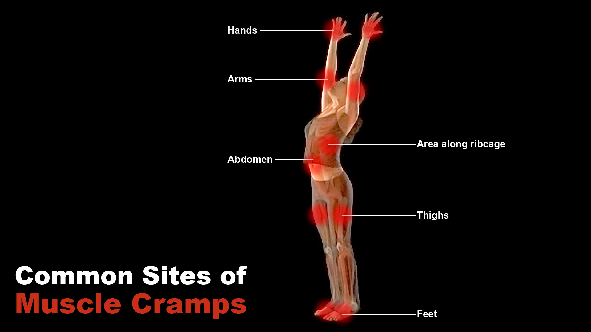Solar Plexus Muscle Cramp