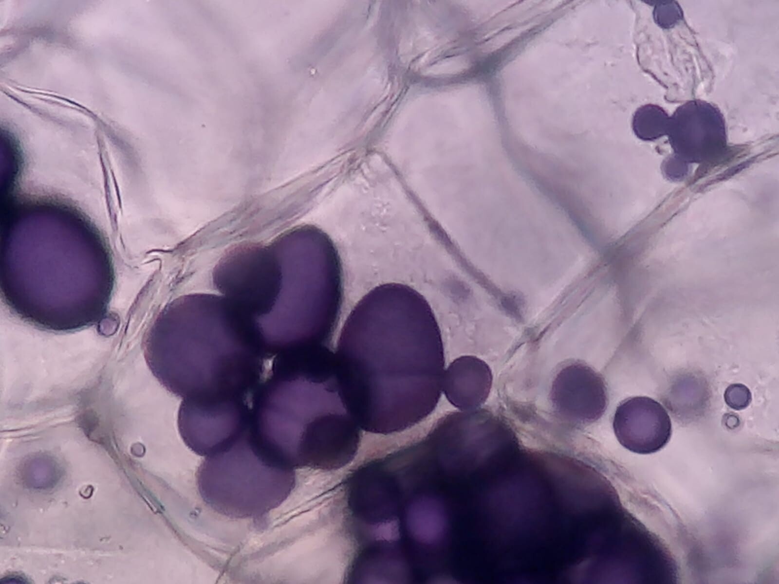 Potato Cells Under A Microscope