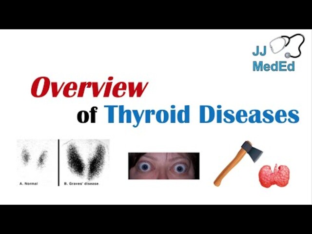 Graves Disease Thyroid Scan