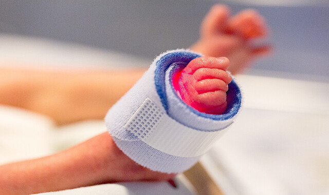 Newborn Pulse Oximetry Screening To Detect Critical Critical