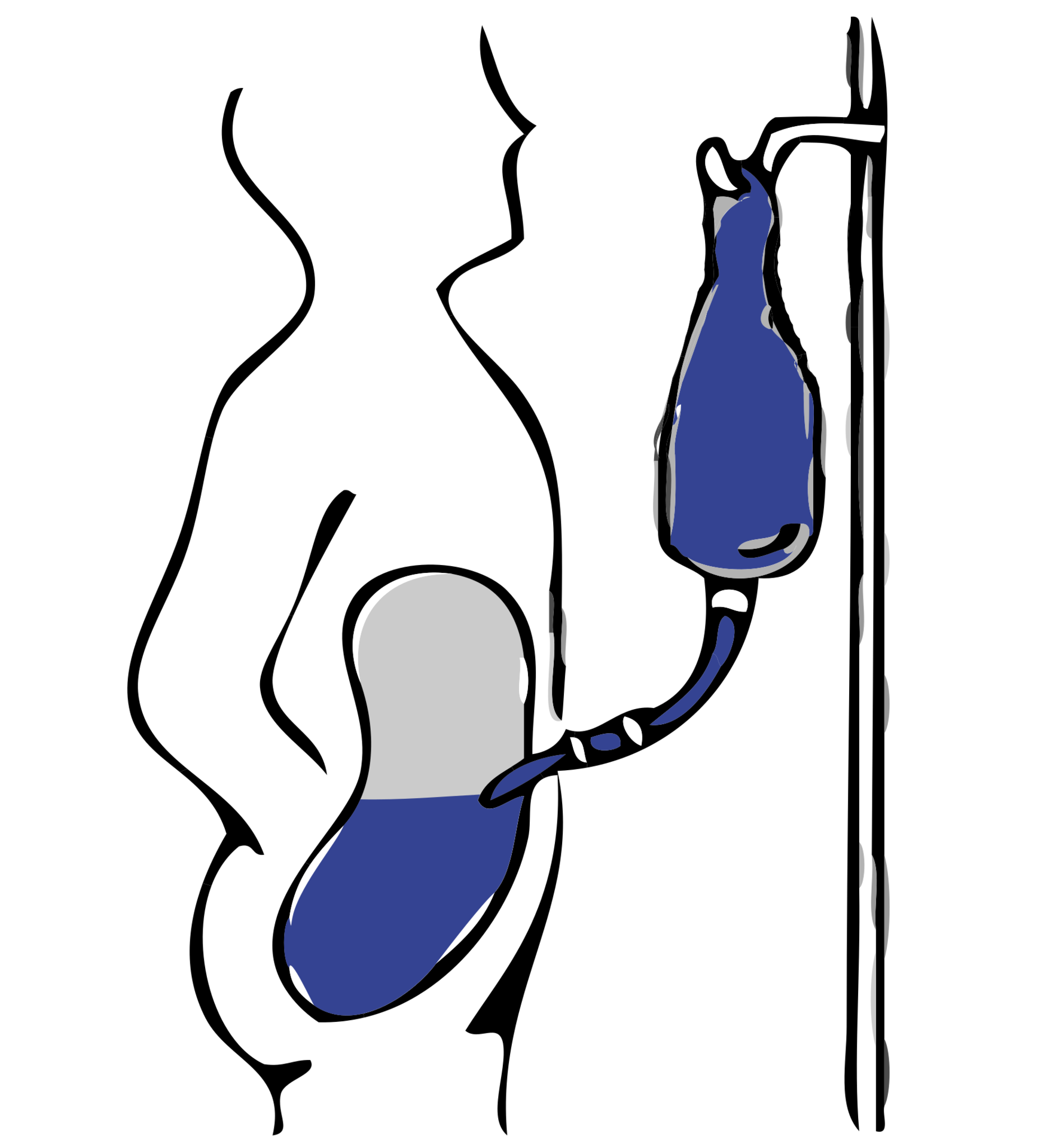 Continuous Ambulatory Peritoneal Dialysis Dwell Time