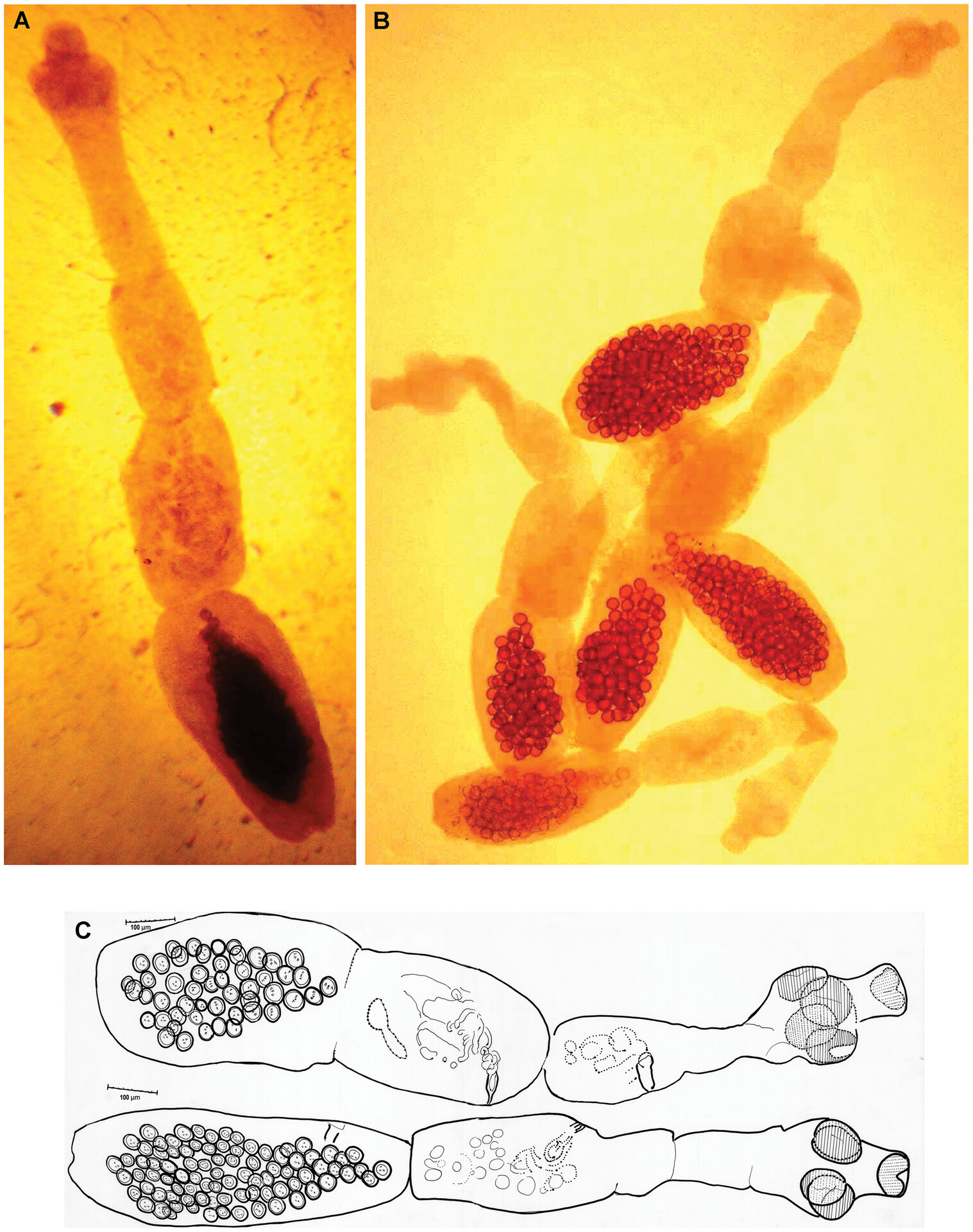 Alveolar Echinococcosis Ae Frequently Asked Questions Faqs Storymd