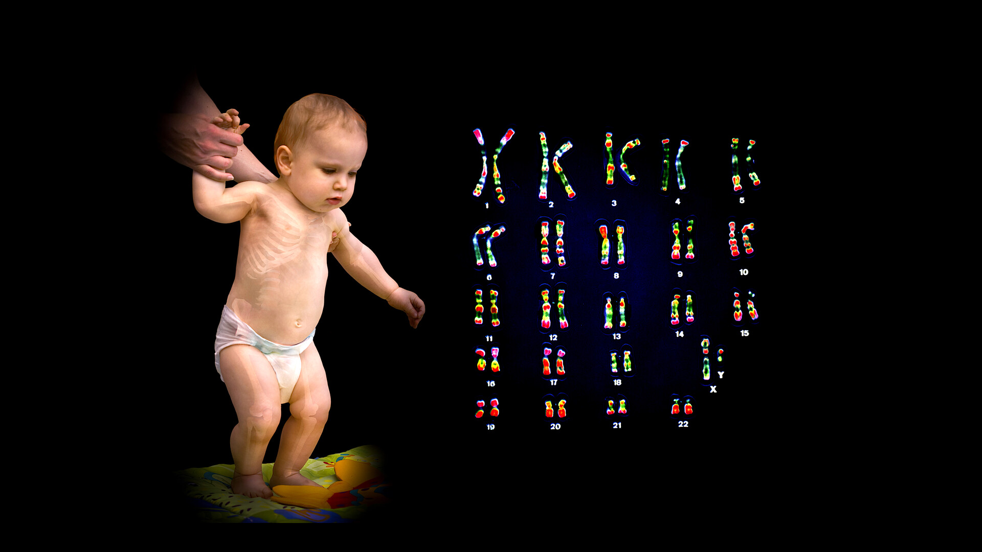 Common Differences Of Sex Development Storymd
