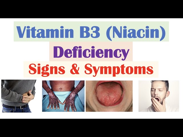 Vitamin B6 Deficiency