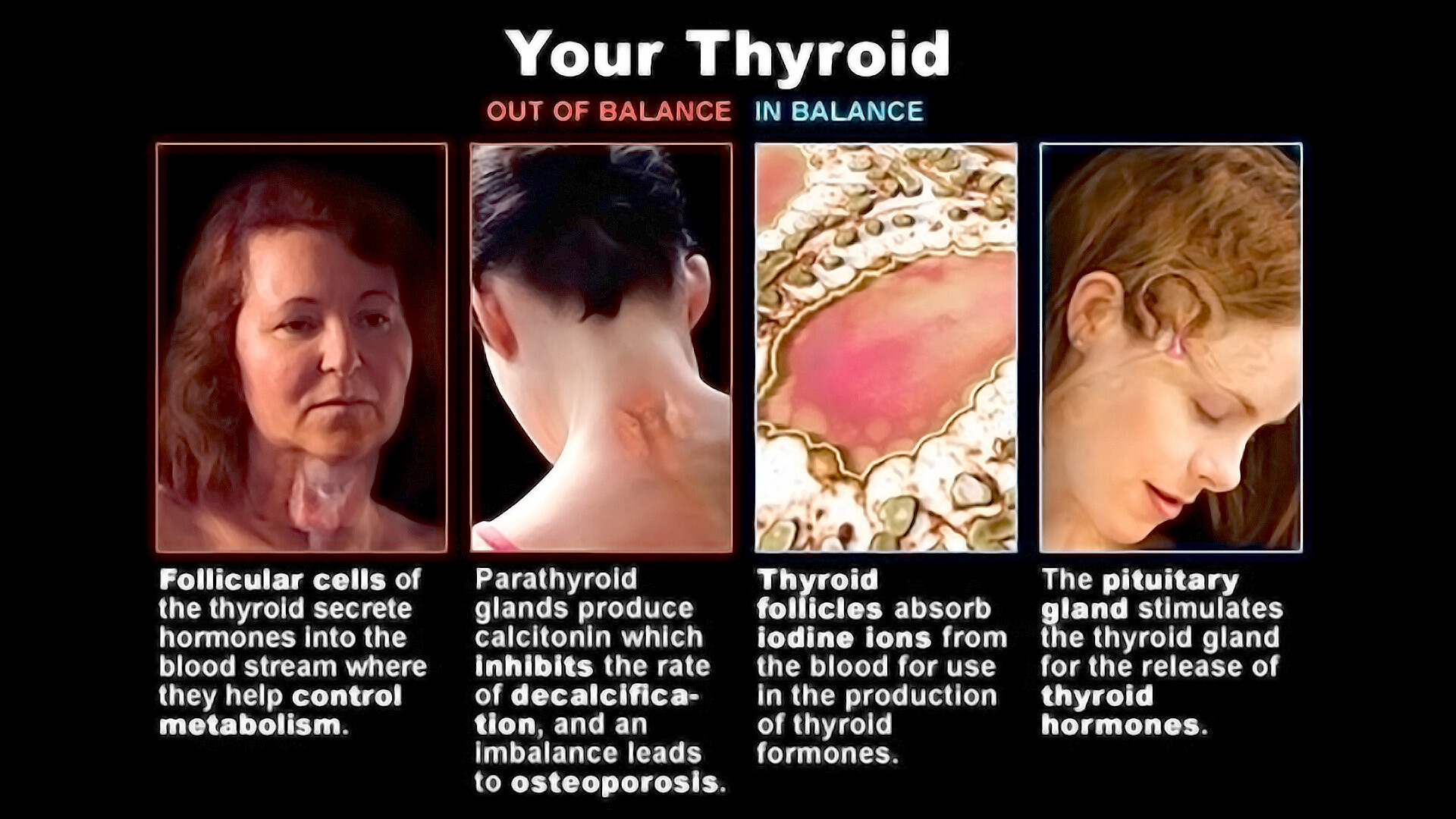 Thyroid Hormones Calcitonin