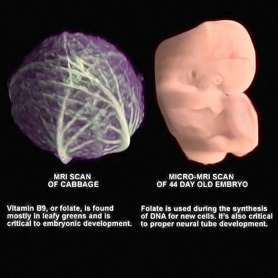 Folic Acid And The Brain