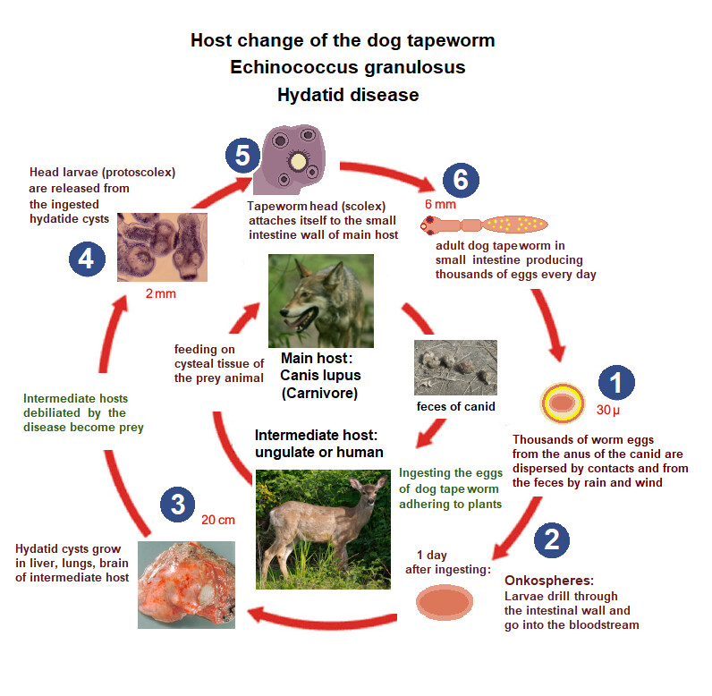 Echinococcus Infection