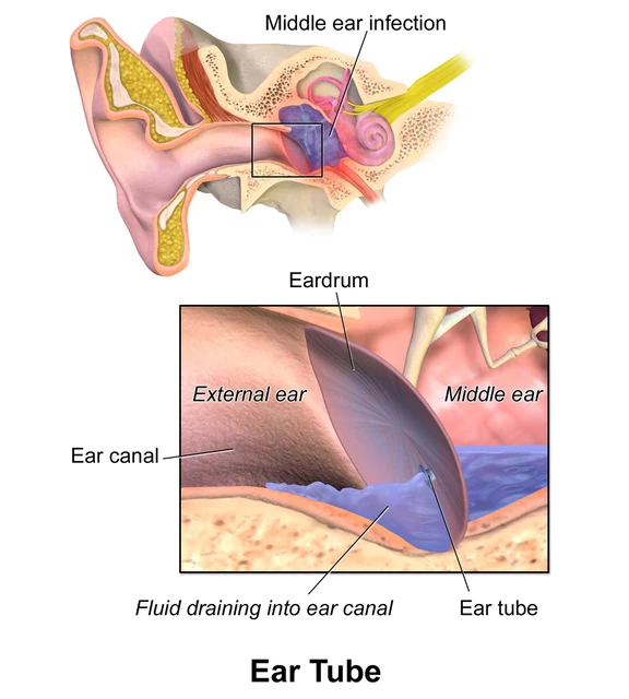Anatomy Of The Auditory System Inner Ear Wikipedia