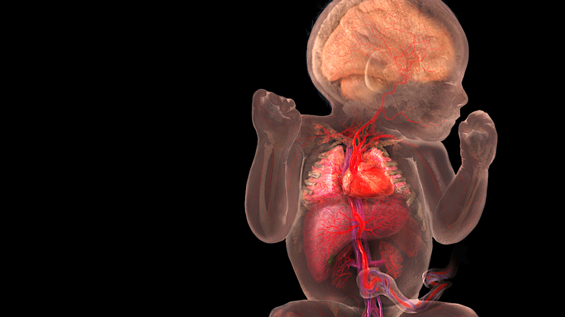 Congenital Heart Defects in Babies: A Tiny Heart, a Big Impact - StoryMD