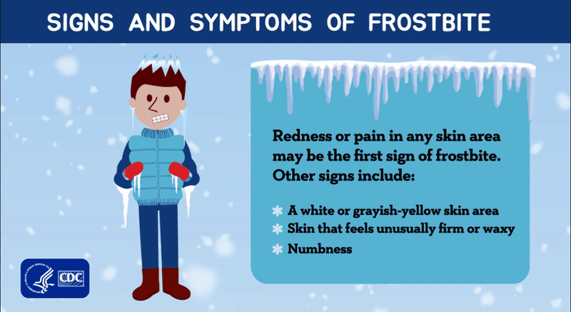 Frostbite On Nose Cartoon