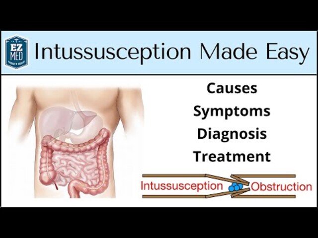 Prevention Of Mother-to-child Transmission Of HIV,, 54% OFF