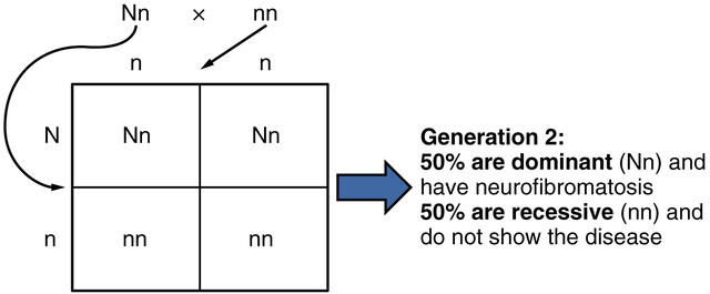Autosomal Dominant Punnett Square Achondroplasia Mendelian Inheritance