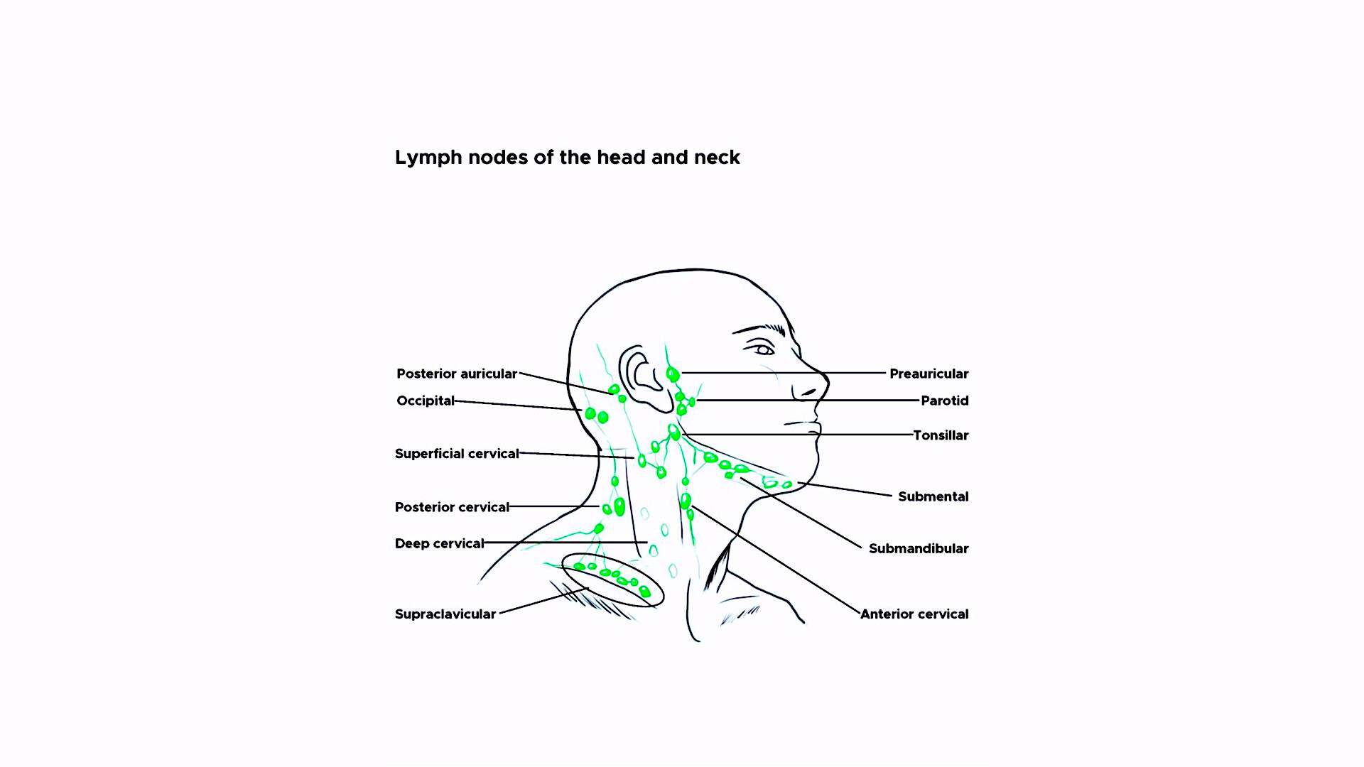 Lymph Nodes In Front Of Neck The Radiology Assistant : Cervical Lymph