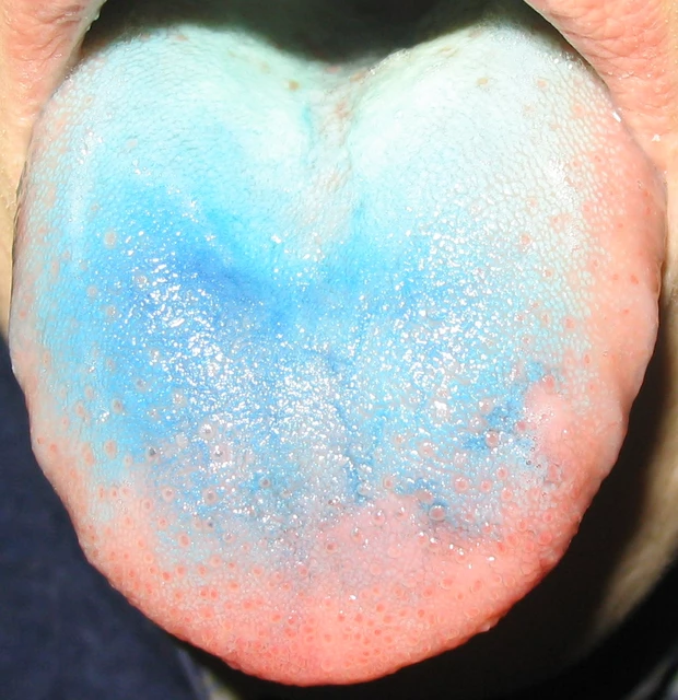 Blue Tongue Causes Bluetongue Disease: Symptoms, Causes, And Control