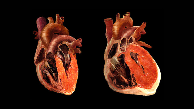 Healthy Human Heart Real