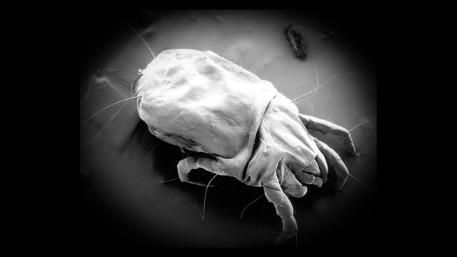 Microscopic Dust Mites