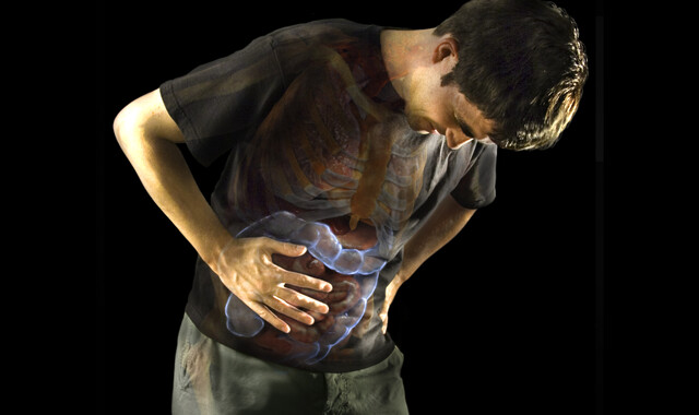 Under 50? Watch Out for These 4 Colon Cancer Red Flags - StoryMD