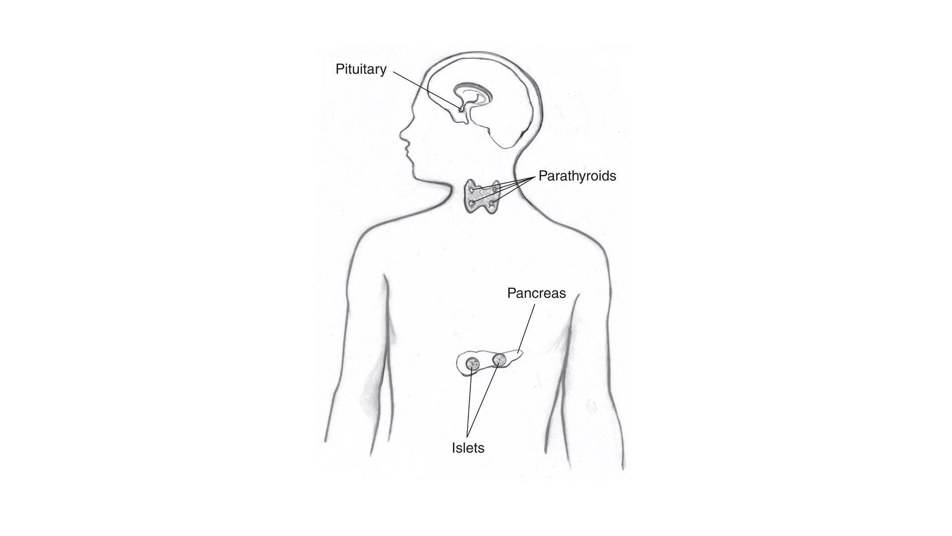 Dna Multiple Endocrine Neoplasia